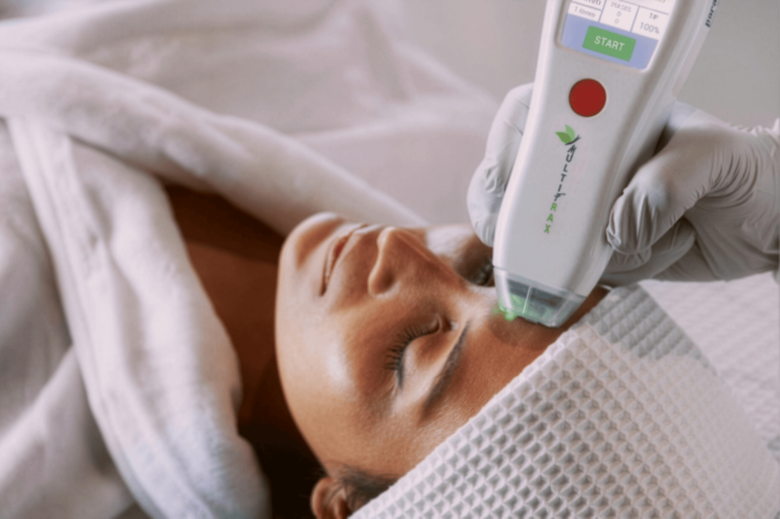 MultiFrax – neste generasjons laserbehandling – først i Norge hos ...